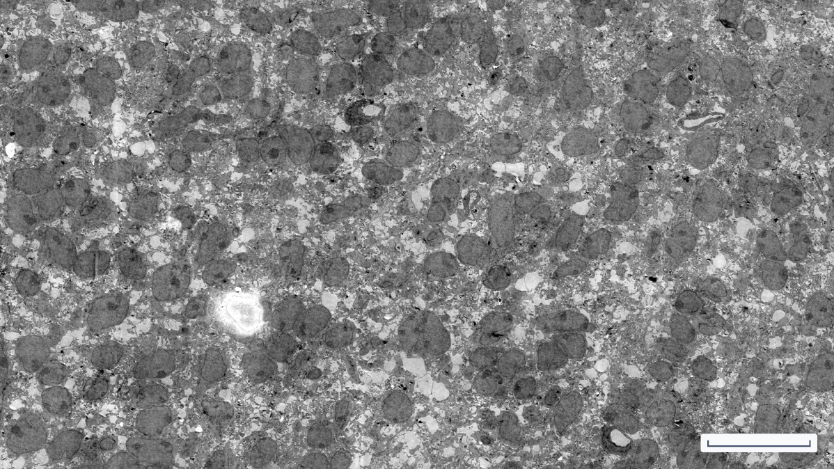 FAST-EM | Ultra-fast automated multibeam electron microscope